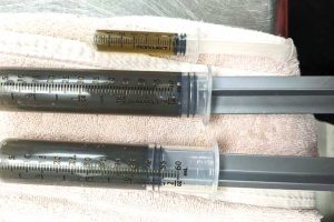 Treating Water Belly (Ascites) In A Chicken - Hobby Farms
